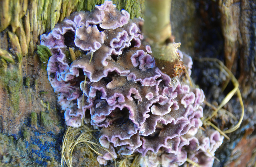 Man infected with killer fungus makes medical history - study - The ...