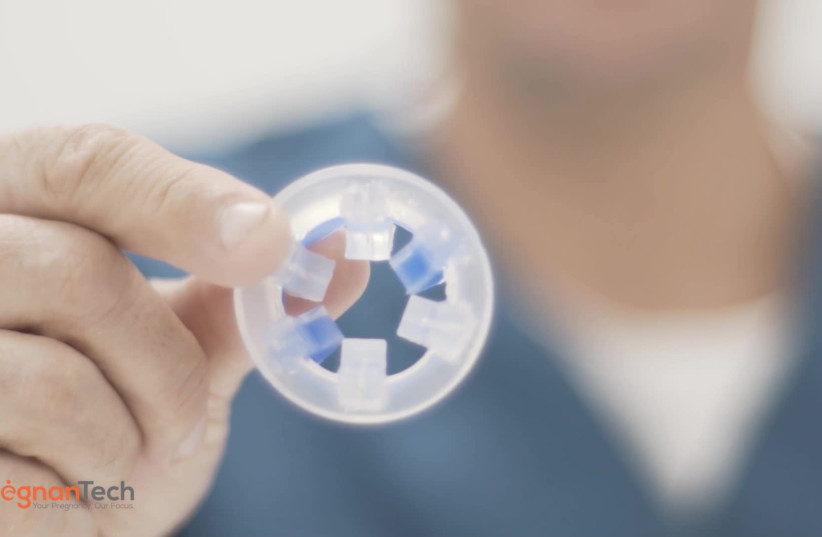 Novel device that prevents preterm birth developed in Israel - The ...