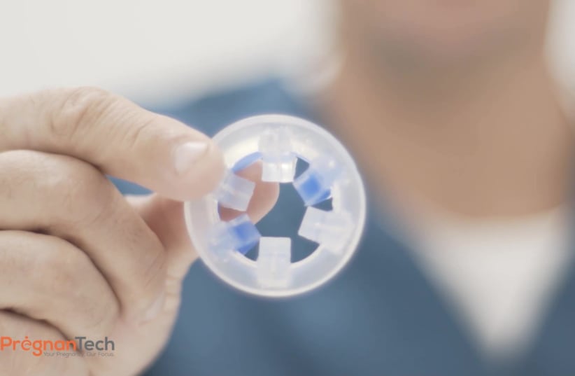 Novel device that prevents preterm birth developed in Israel - The ...