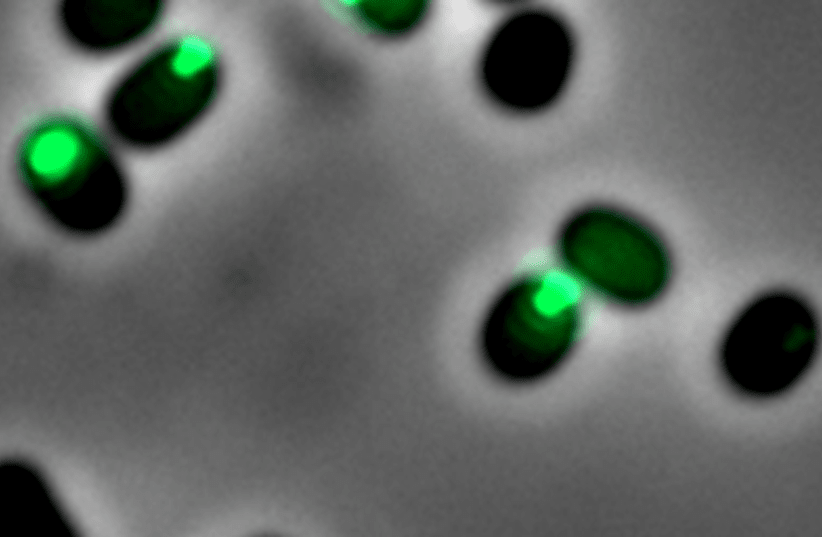 Israeli researchers make discovery to help fight bacterial infections ...